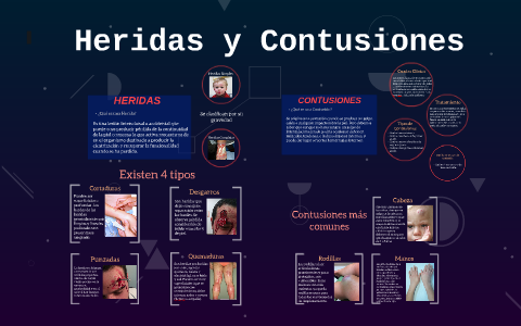 Heridas y Contusiones by Bárbara Briones on Prezi