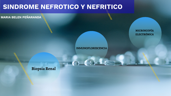 SINDROME NEFROTICO Y NEFRITICO by Kurt Ledger on Prezi