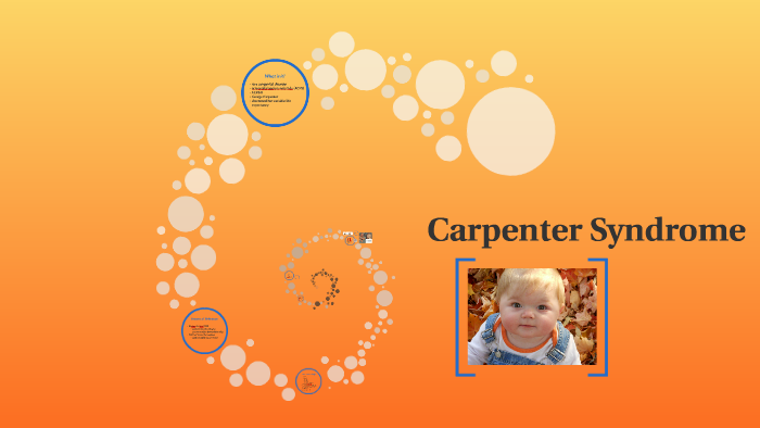 Carpenter Syndrome by A Overfield on Prezi