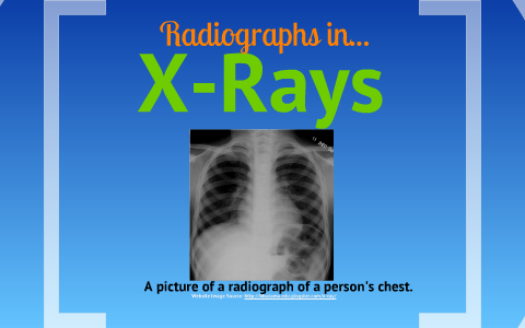 X-Rays Science Project (Good Copy) by adam ali on Prezi