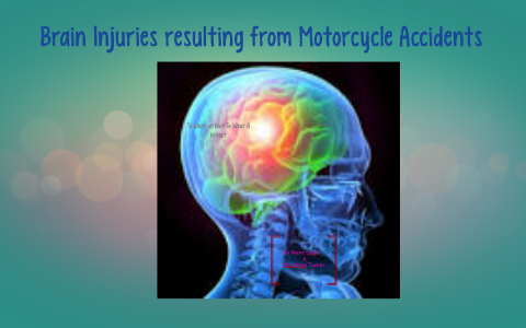 Brain Injuries from Motorcycle Accidents by Vonna Tucker on Prezi