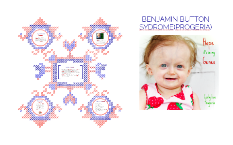 BENJAMIN BUTTON SYDROME (PROGERIA) by Atikah Sham on Prezi
