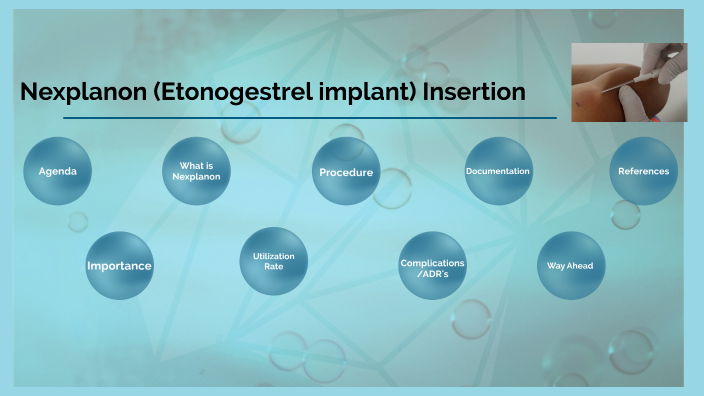 Nexplanon Procedure by Lisa Kasper on Prezi
