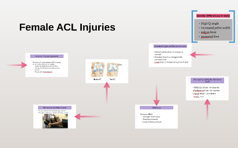 Female ACL Injuries by Hannah Short on Prezi