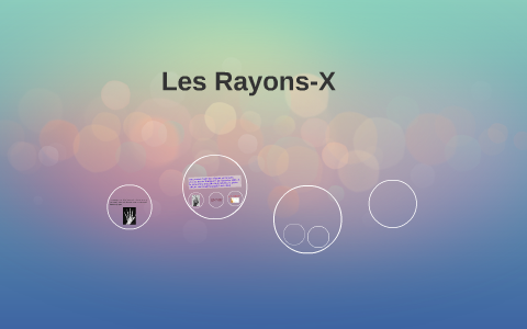 Les Rayons-X by Haylie Barnes on Prezi