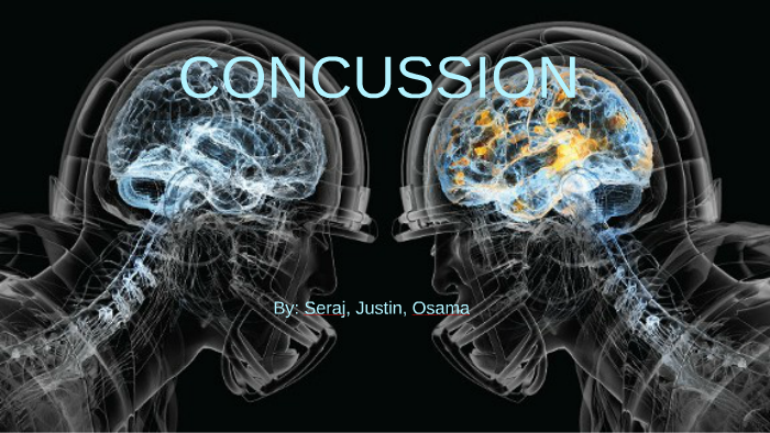Concussion Science Project by osama khalil on Prezi