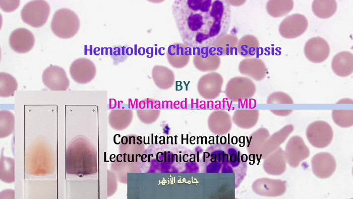 Hematologic Changes in Sepsis by Dr.Mohamed Hanafy on Prezi