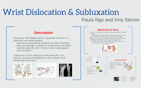 Wrist Dislocation & Subluxation by Paula N