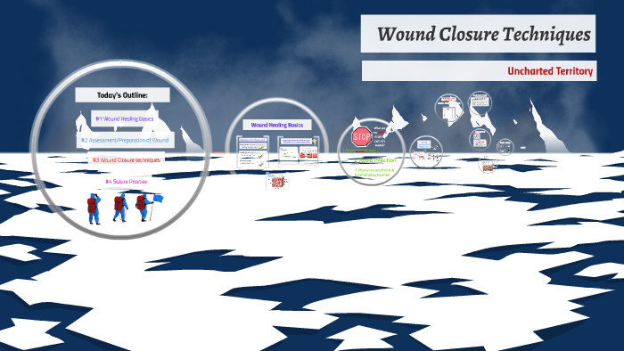 Wound Closure Techniques by Laura Mattson on Prezi