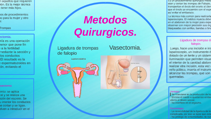Metodos Quirurgicos by Vanesa Hernandez on Prezi