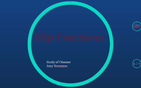 Hip Fractures by amy youmans on Prezi
