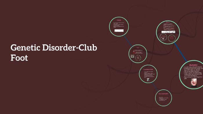 Genetic Disorder-Club Foot by Davis Williams on Prezi