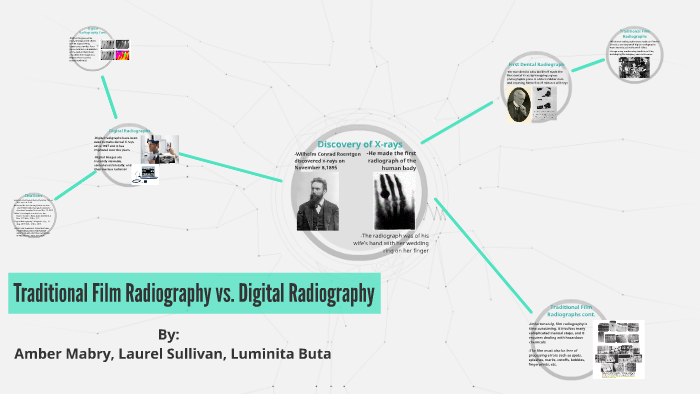 Traditional Film Radiography vs. Digital Radiography by Light Cloud on ...