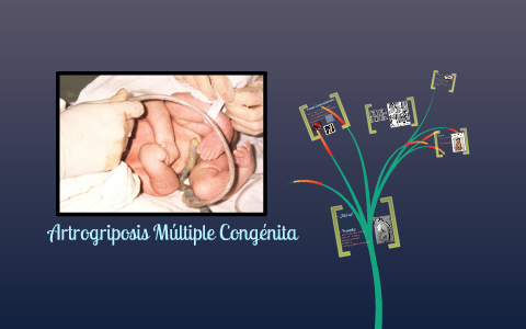 Artrogriposis Múltiple Congénita by Gaby Gavilán on Prezi