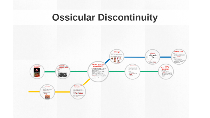 Ossicular Discontinuity by Cadey Collishaw on Prezi