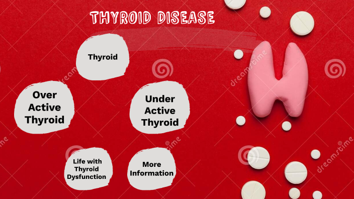 Thyroid Disease by Chelsea Hurd on Prezi