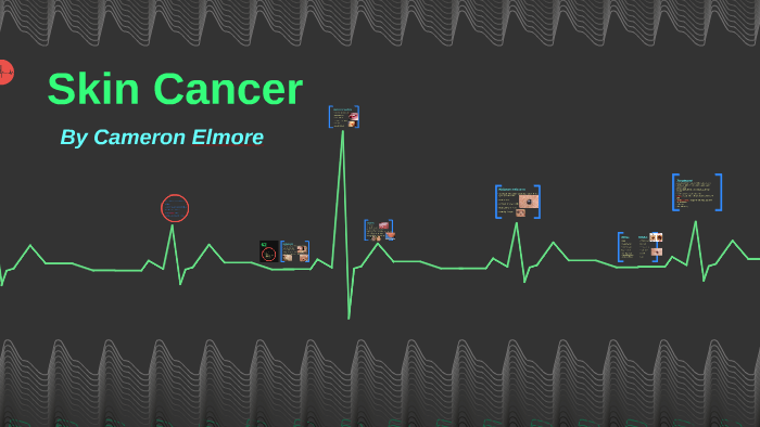 Skin Cancer by Cameron Elmore on Prezi