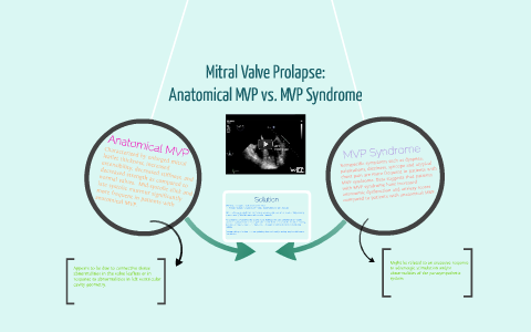 Anatomical MVP vs. MVP syndrome by Kristi Sroka on Prezi
