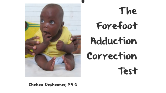 The Forefoot Adduction Correction Test by Chelsea Dexheimer on Prezi