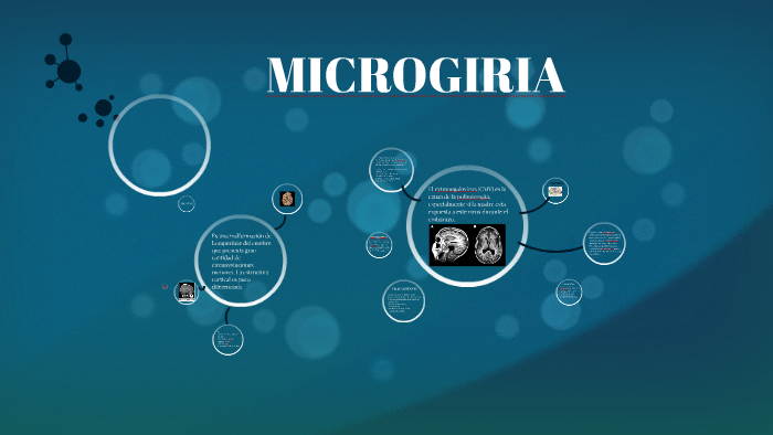 MICROGIRIA by Naia Marca on Prezi