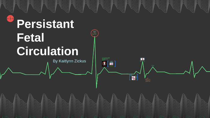Persistant Fetal Circulation by Kaitlynn Zickus on Prezi