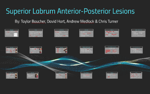 Superior Labrum Anterior-Posterior Lesions by Taylor Boucher on Prezi