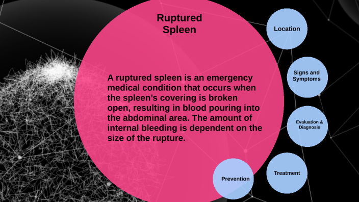 Medical Project Group 2 by Sohan Parikh on Prezi