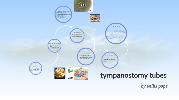 tympanostomy tubes by willis pope on Prezi