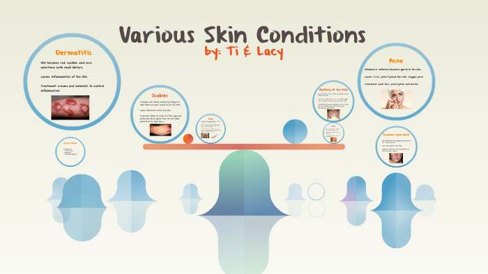 Various Skin Conditions by lacy archer on Prezi