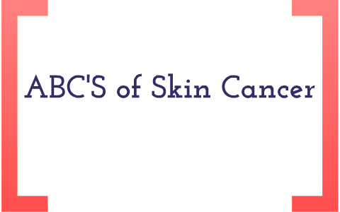 ABC'S OF SKIN CANCER by brandon lewis on Prezi