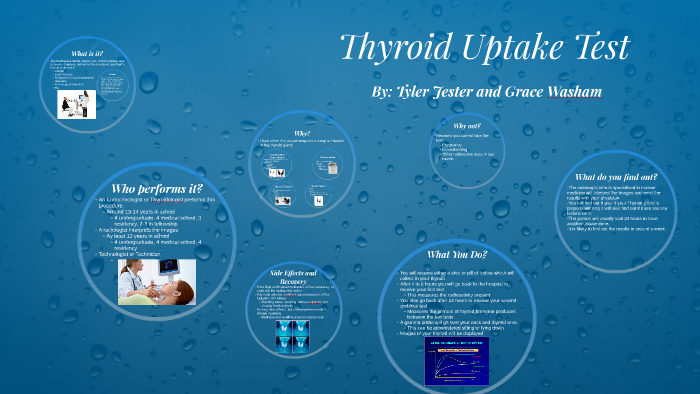 Thyroid Uptake Test by Tyler Jester on Prezi