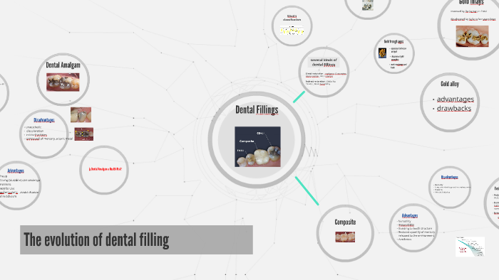 The evolution of dental filling by Danyal Fidahoussen on Prezi