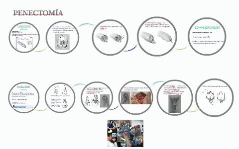 PENECTOMÍA by on Prezi