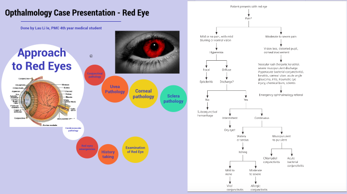 Ophthalmology case presentation by LAU LI IE on Prezi