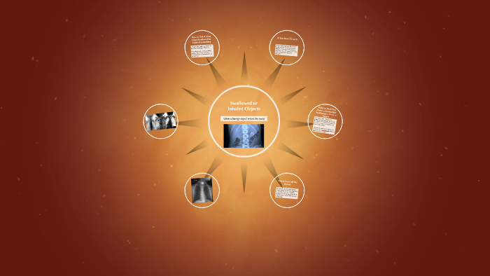 Swallowed or Inhaled Objects by Cheyenne Womack on Prezi
