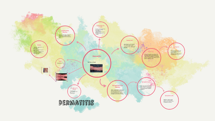Dermatitis by Autumn Shook on Prezi