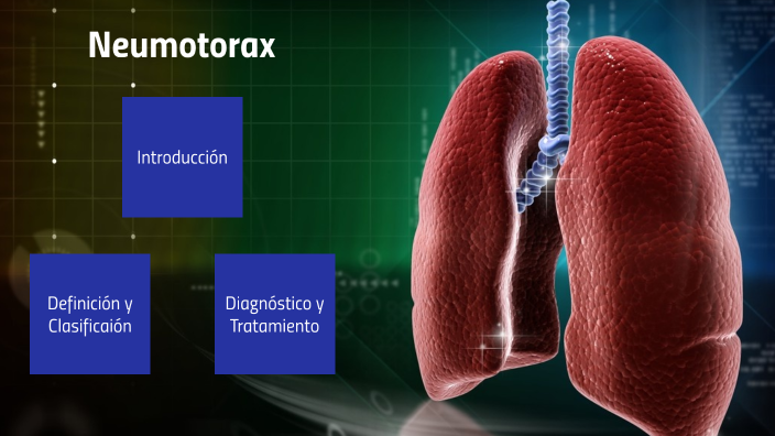 NEUMOTORAX by Rodrigo Andrés Guzmán Rosales on Prezi
