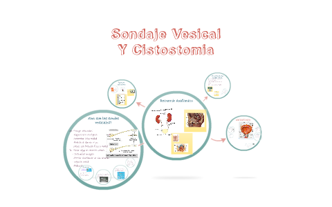 Cistostomia by Valeria Oliva on Prezi