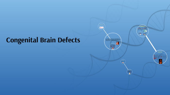 Congenital Brain Defects by Stephanie ramirez on Prezi