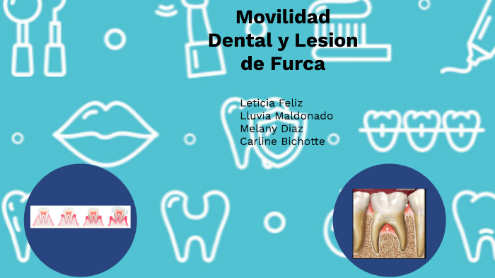 Movilidad dental y lesion de furca by Leticia Feliz on Prezi