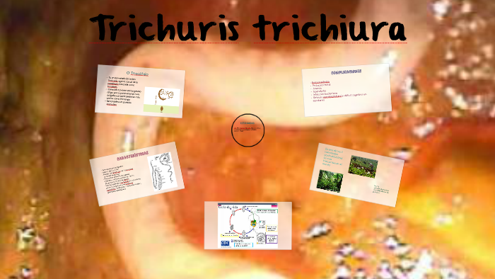 Trichuris trichiura by Marce Chiio on Prezi