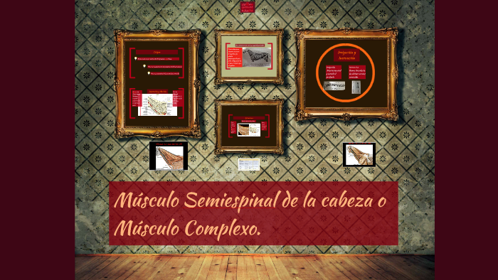 Músculo Semiespinal de la cabeza o Músculo Complexo. by Nicole ...