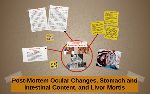 Post-Mortem Ocular Changes, Stomach and Intestinal Content, by Charlie ...