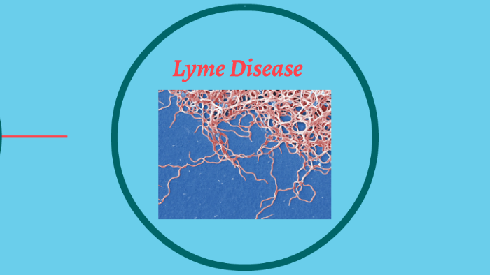 Lyme Disease by Jessica Tousignant