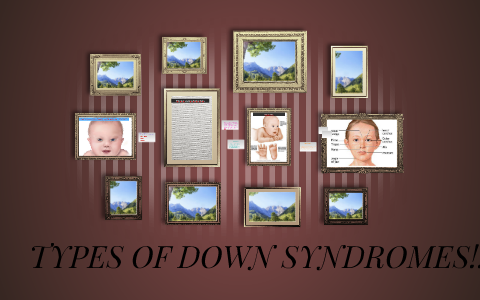 TYPES OF DOWN SYNDROMES!!! by fatima rivette on Prezi