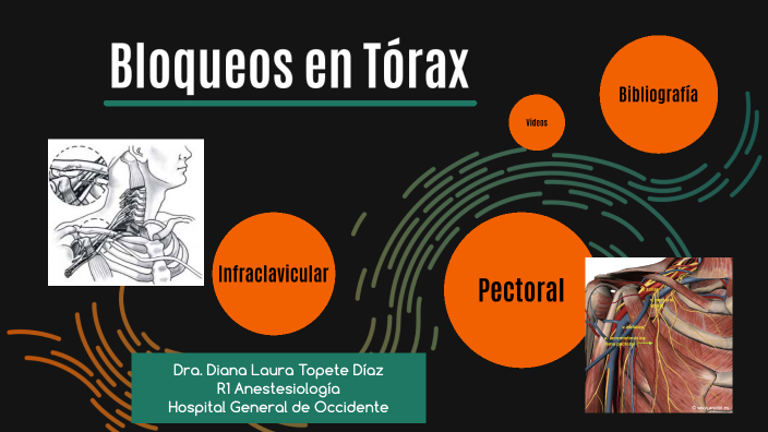 Bloqueos en torax by Diana Laura Topete Diaz on Prezi