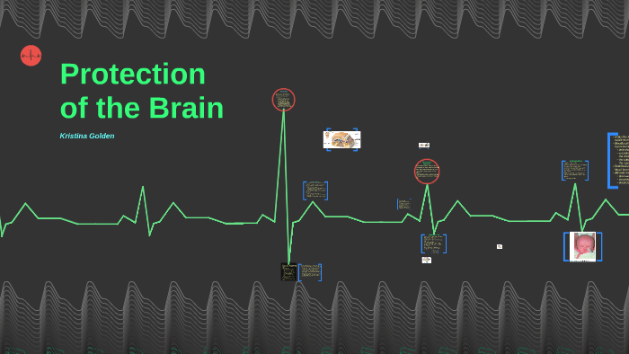 Protection of the Brain by Kristina Golden on Prezi