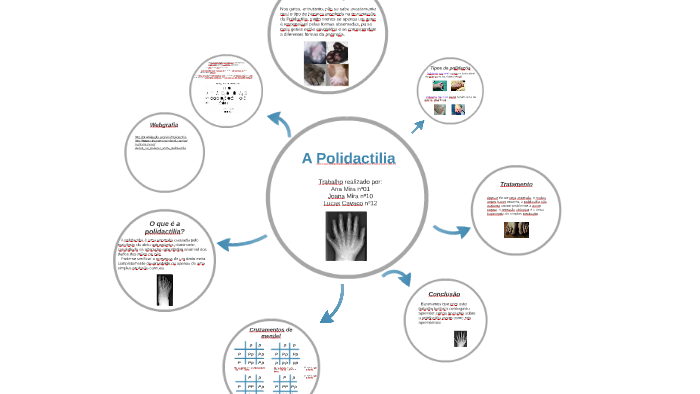 A Polidactia by Ana Mira on Prezi