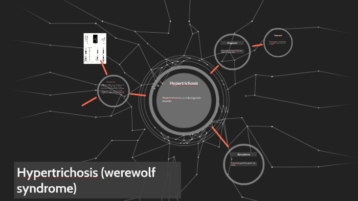 Hypertrichosis (werewolf syndrome) by izac esco on Prezi