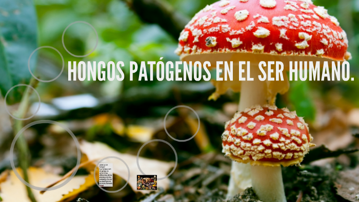 HONGOS PATOGENOS EN EL SER HUMANO by alejandra Bustamante G on Prezi